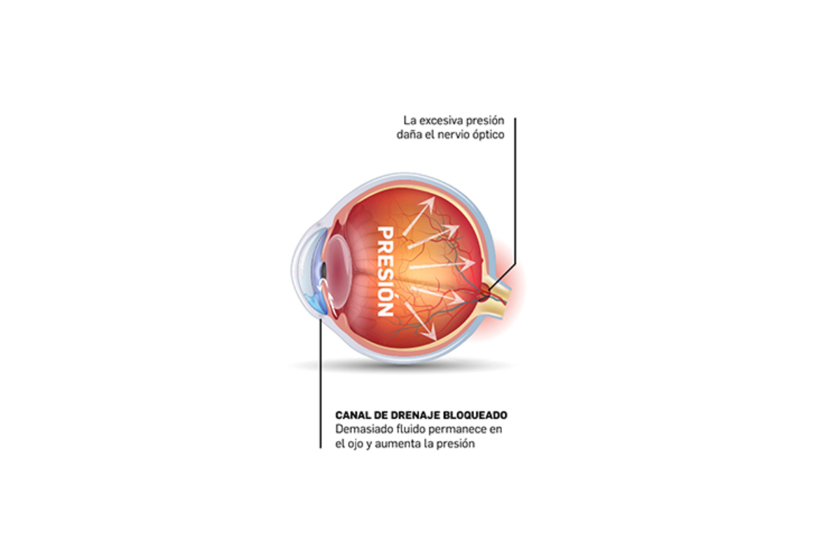 Farmacéuticos Promueven La Prevención Precoz Del Glaucoma Im Farmacias